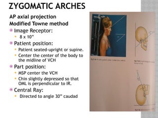 Radiographic positioning II. Skull positioning | PPTX