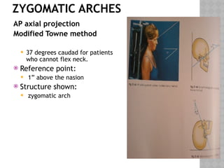 Radiographic positioning II. Skull positioning | PPTX