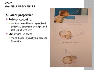 Radiographic positioning II. Skull positioning | PPTX