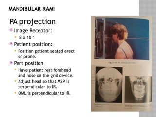 Radiographic positioning II. Skull positioning | PPTX