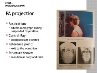 Radiographic positioning II. Skull positioning | PPTX
