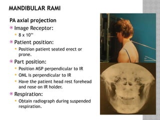 Radiographic positioning II. Skull positioning | PPTX