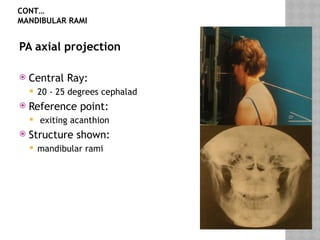 Radiographic positioning II. Skull positioning | PPTX