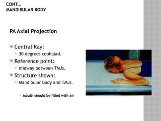 Radiographic positioning II. Skull positioning | PPTX