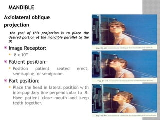 Radiographic positioning II. Skull positioning | PPTX