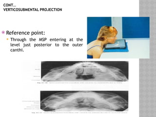 Radiographic positioning II. Skull positioning | PPTX