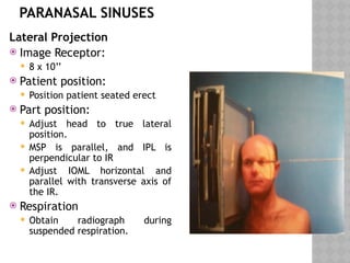 Radiographic positioning II. Skull positioning | PPTX