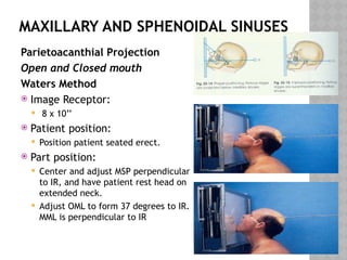 Radiographic positioning II. Skull positioning | PPTX