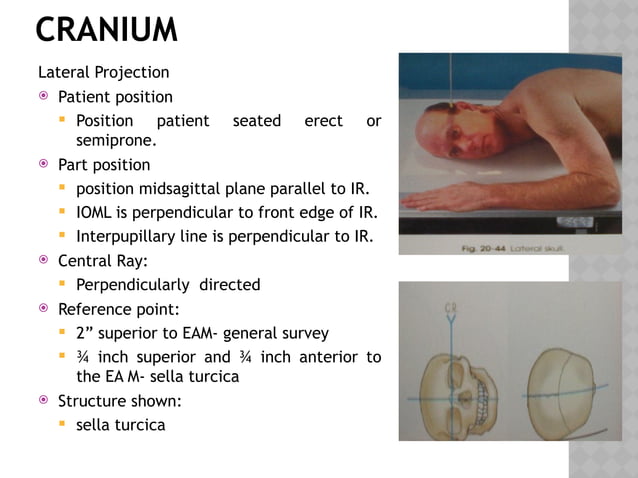 Radiographic positioning II. Skull positioning | PPTX
