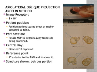 Radiographic positioning II. Skull positioning | PPTX