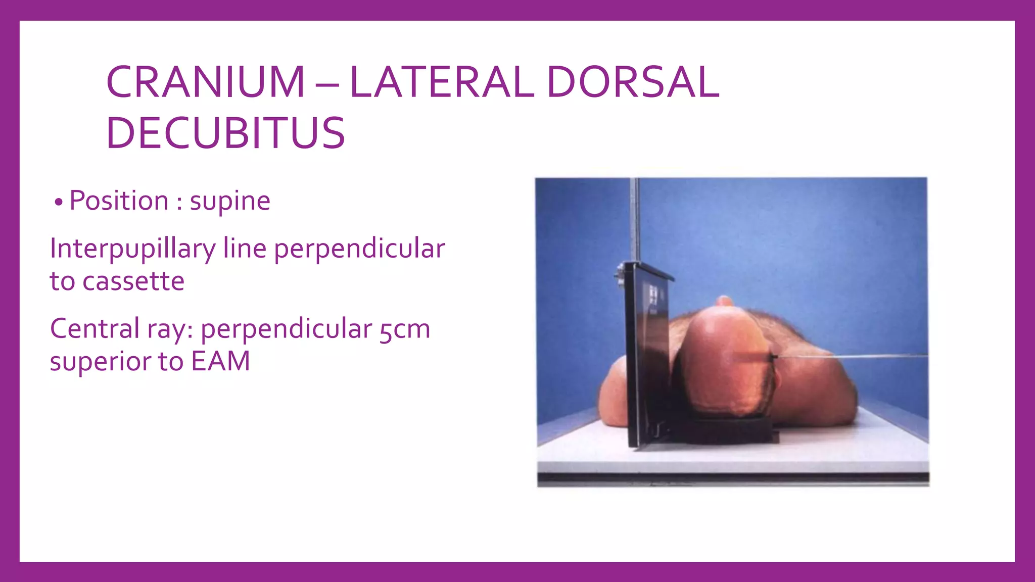 Skull Radiography techniques and reporting | PPTX