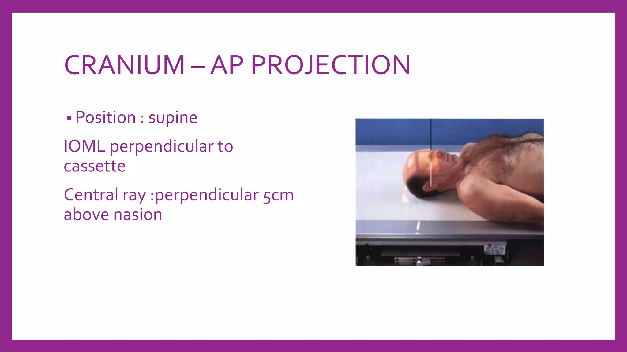 Skull Radiography techniques and reporting | PPTX