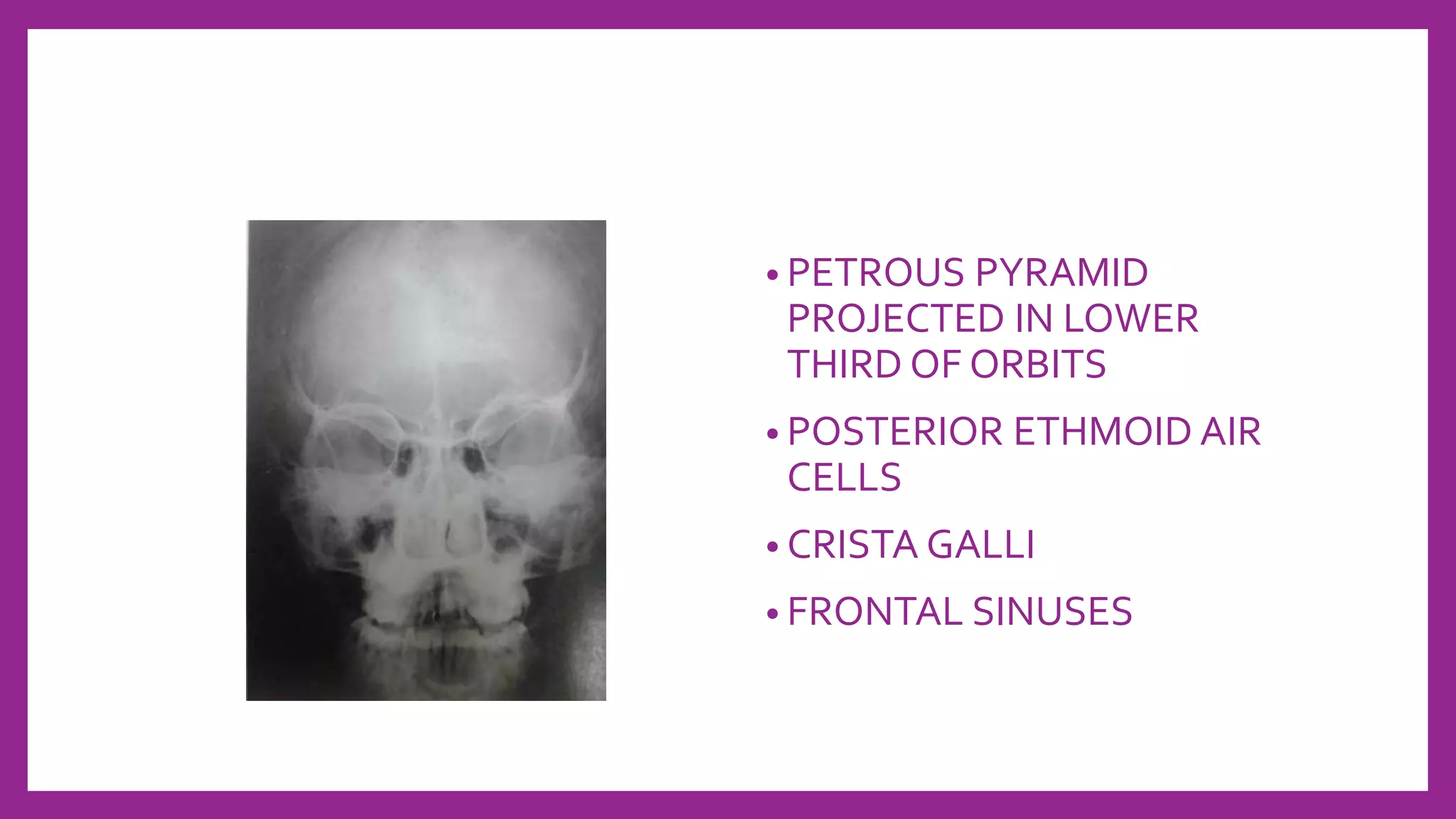 Skull Radiography techniques and reporting | PPTX