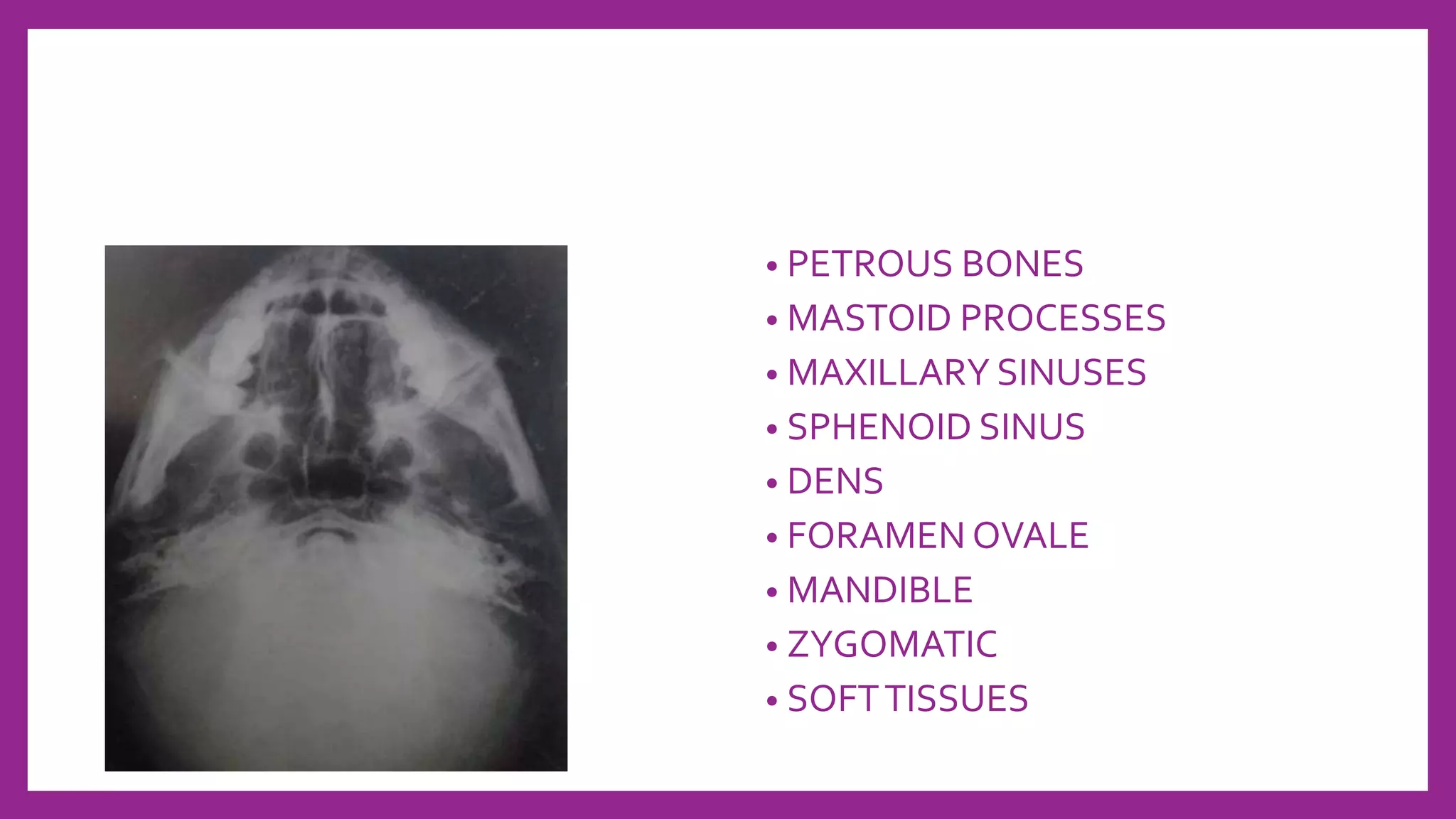 Skull Radiography techniques and reporting | PPTX