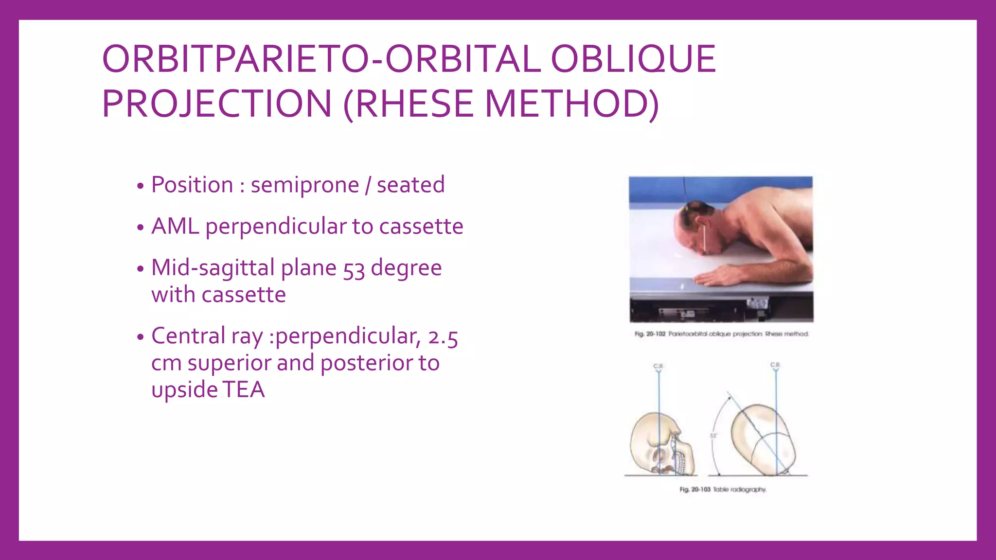 Skull Radiography techniques and reporting | PPTX