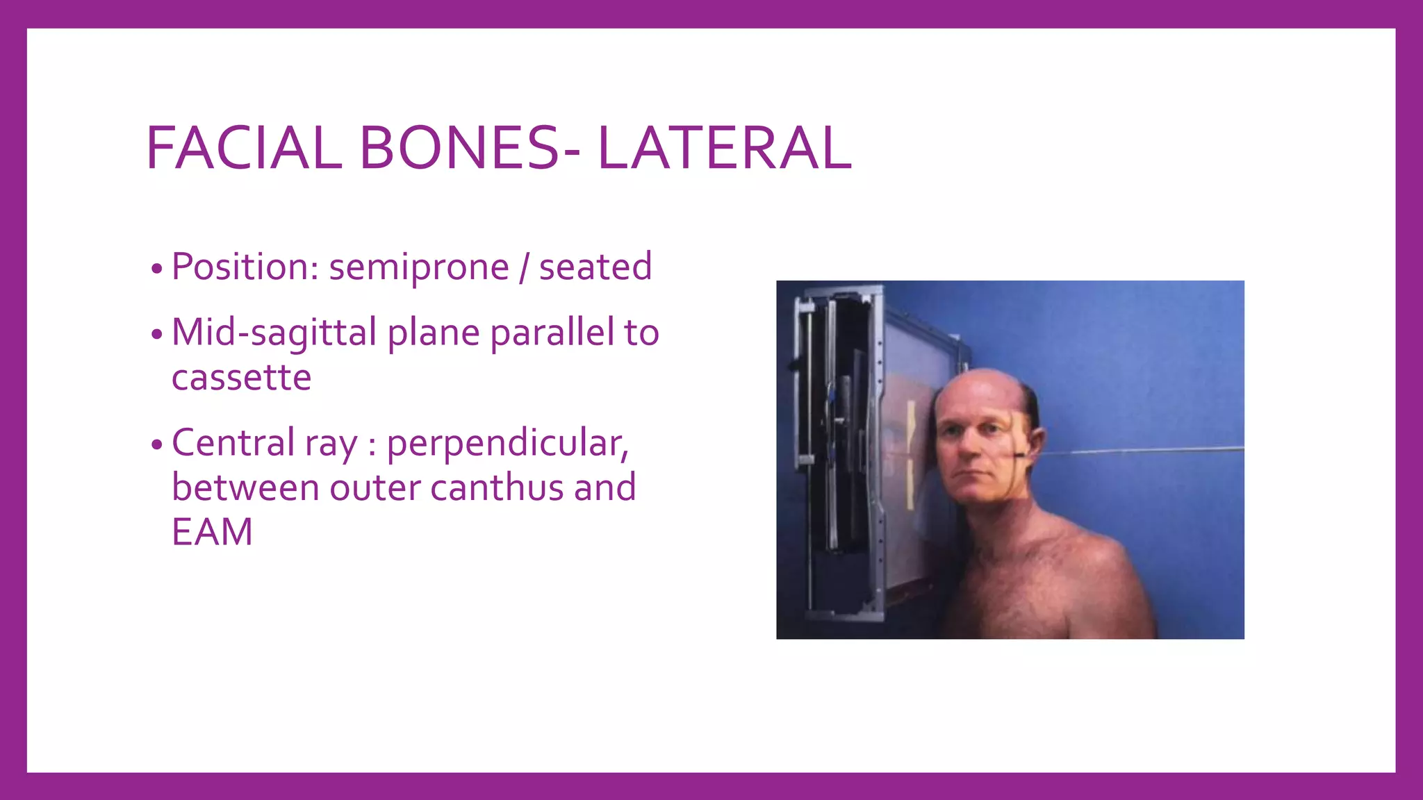 Skull Radiography techniques and reporting | PPTX