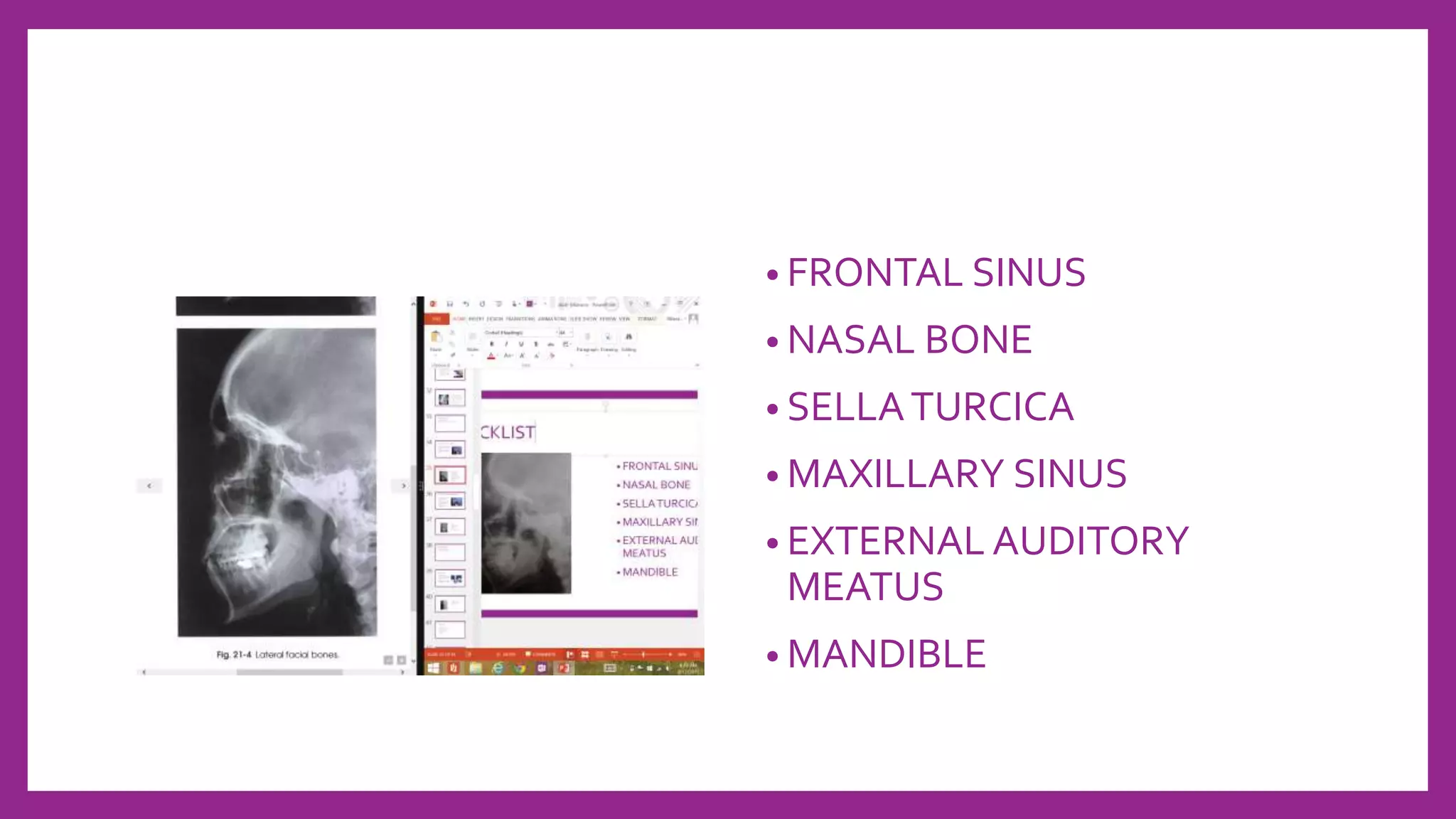 Skull Radiography techniques and reporting | PPTX