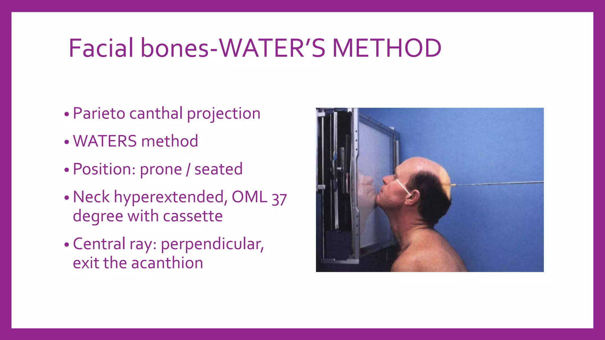 Skull Radiography techniques and reporting | PPTX