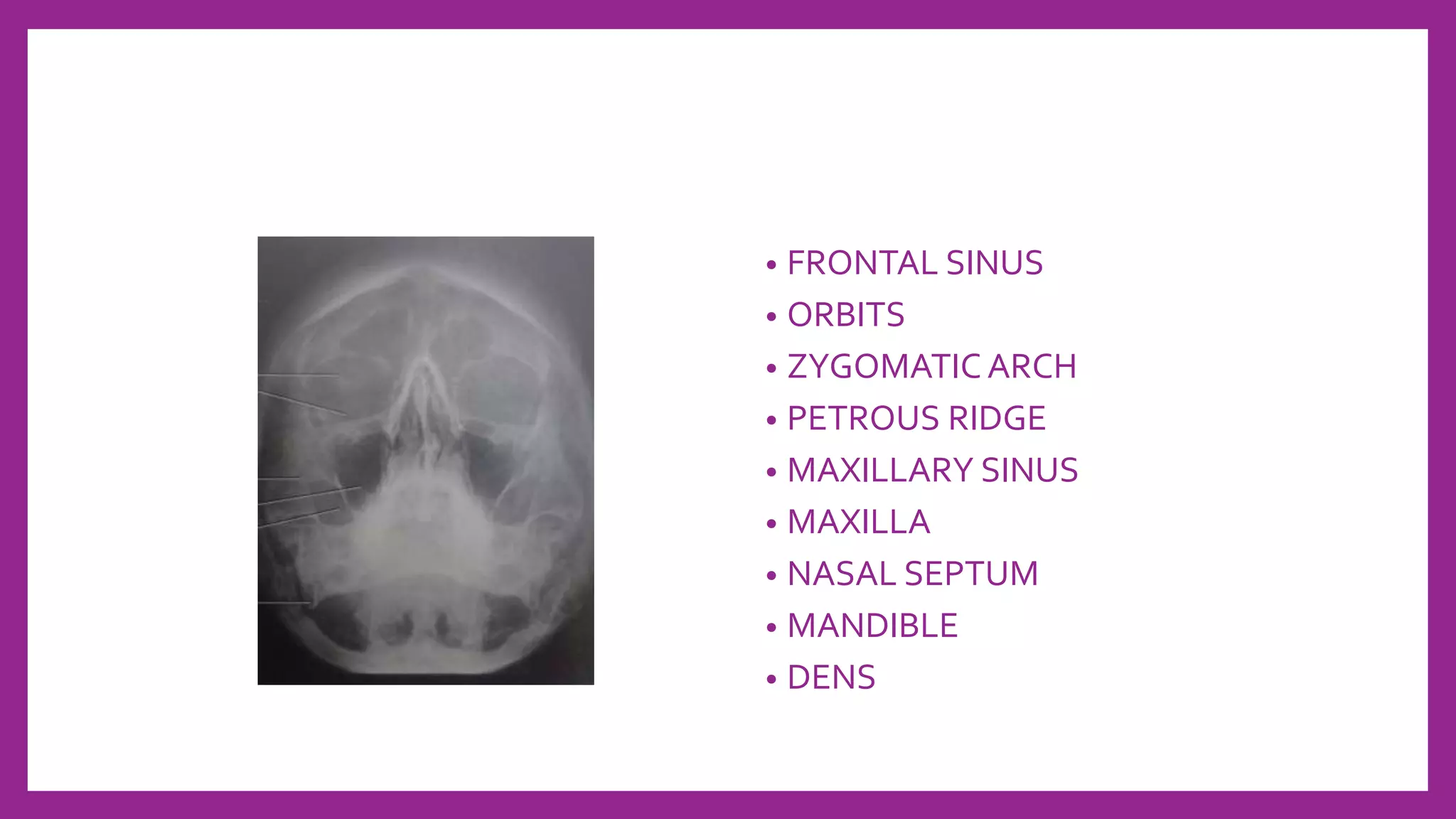 Skull Radiography techniques and reporting | PPTX