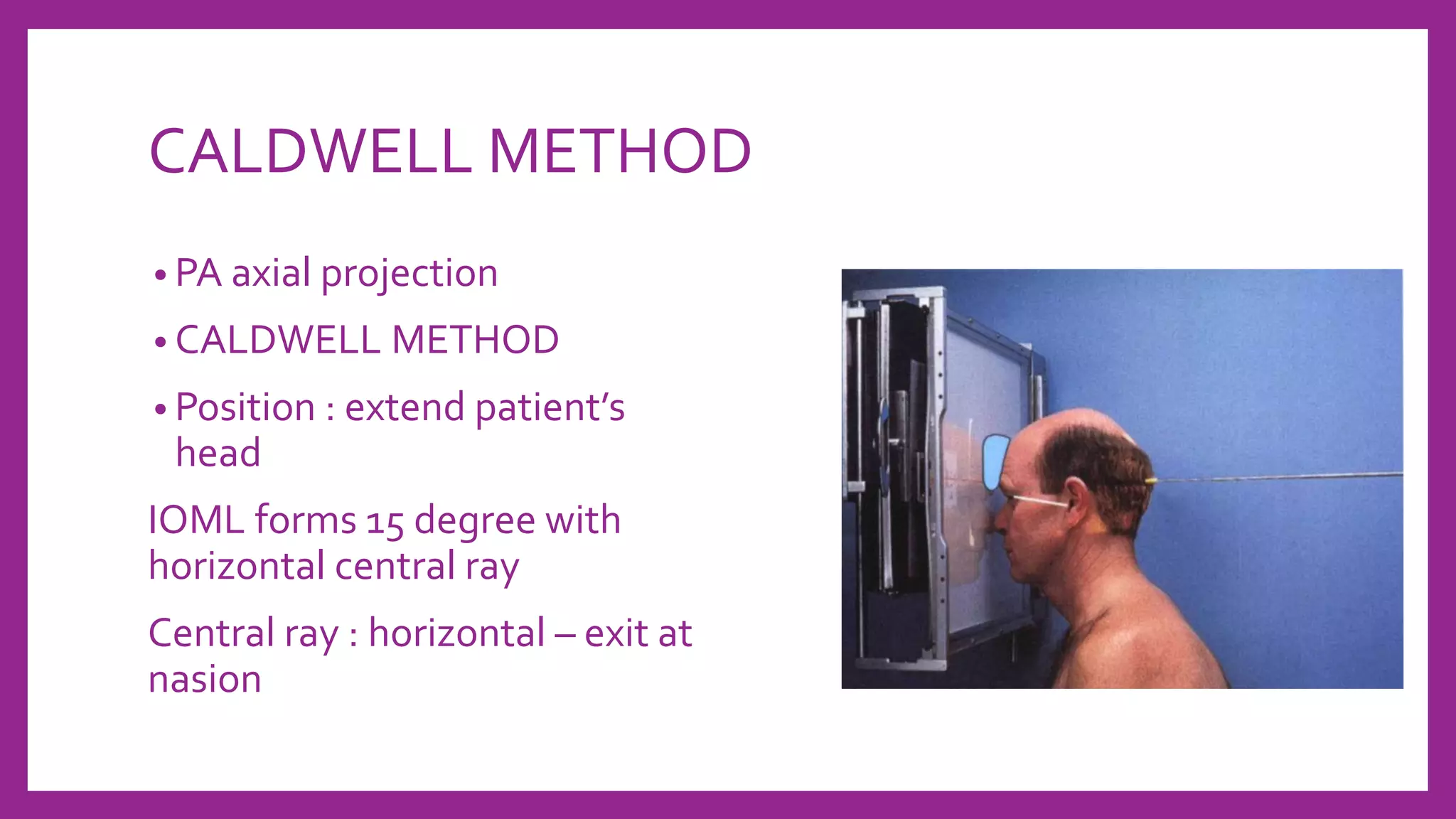 Skull Radiography techniques and reporting | PPTX