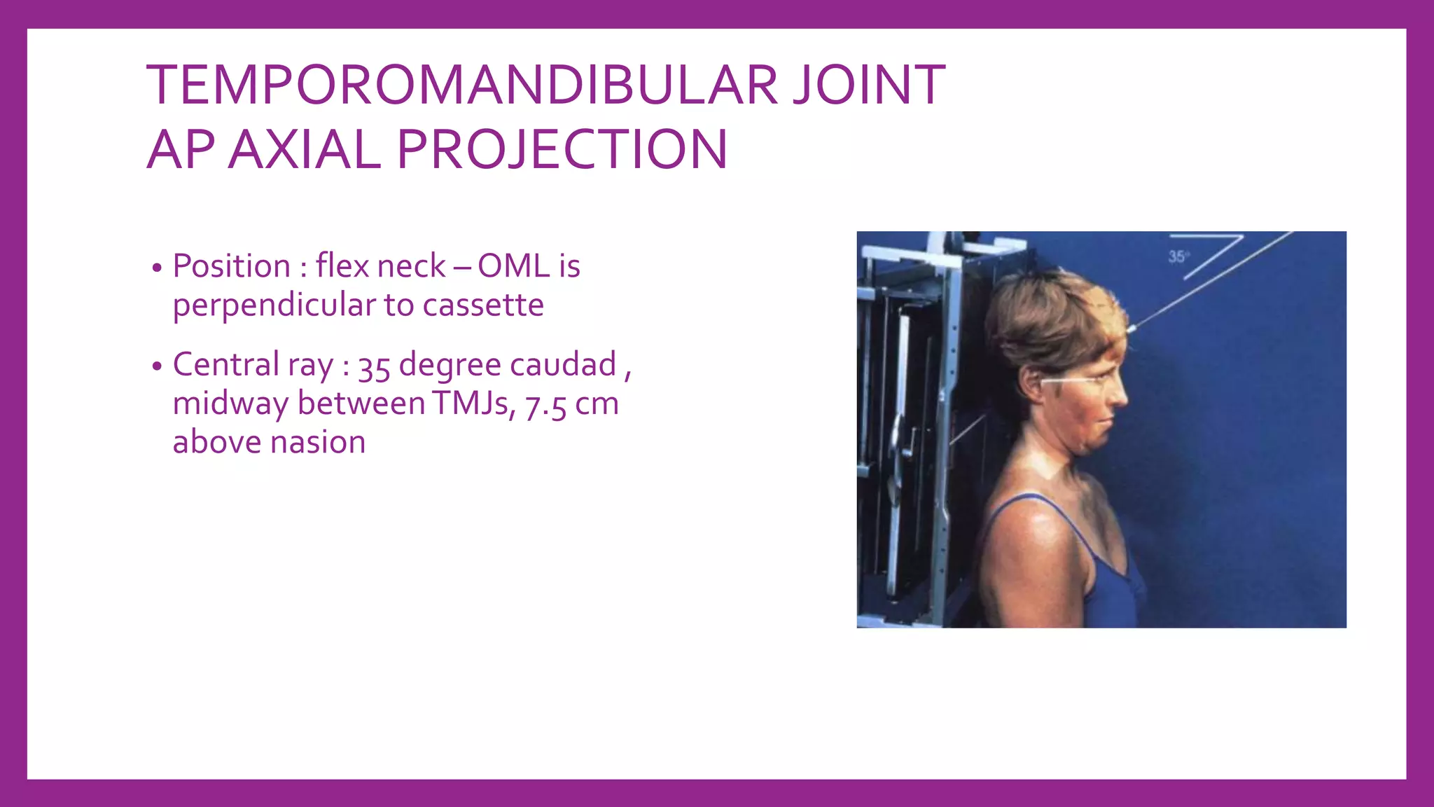 Skull Radiography techniques and reporting | PPTX