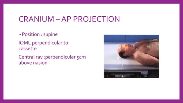 Skull Radiography techniques and reporting | PPTX | Ear, Nose and ...