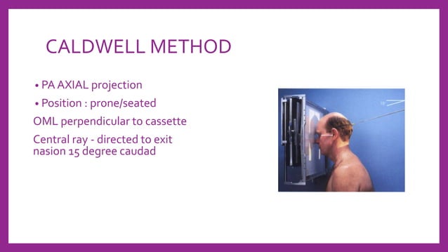 Skull Radiography techniques and reporting | PPTX | Ear, Nose and ...