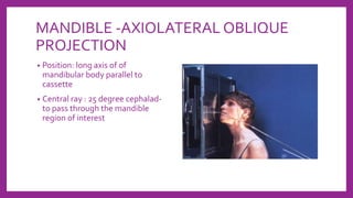 Skull Radiography techniques and reporting | PPTX