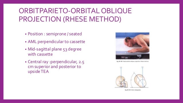 Skull Radiography techniques and reporting