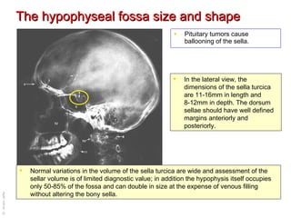 Skull inside and some separate bones | PPT