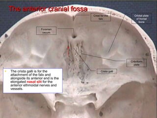 Skull inside and some separate bones | PPT