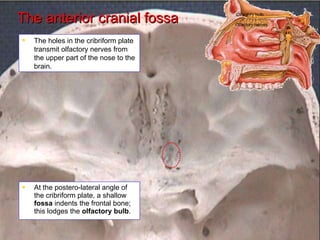 Skull inside and some separate bones | PPT