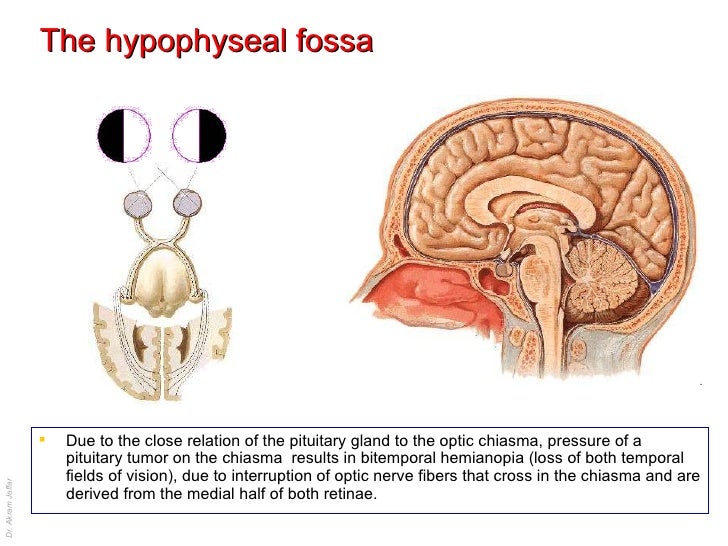 Skull inside and some separate bones