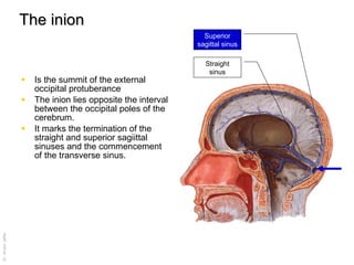 Skull the normas | PPT | Death, Injury, or Military Conflict | Sensitive Topics