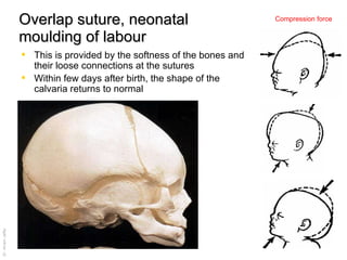 Skull the normas | PPT