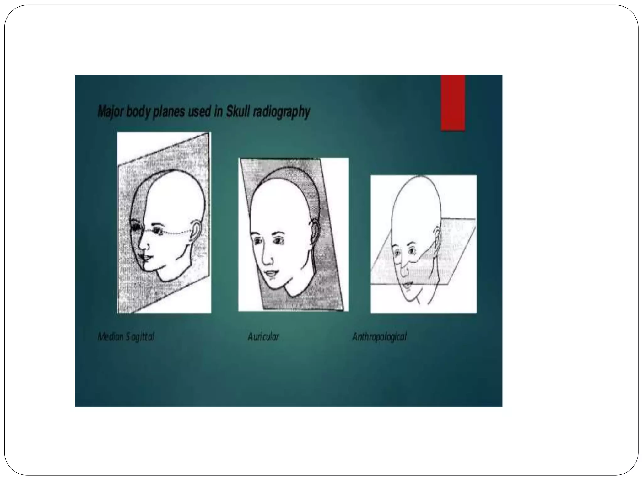 Skull anatomy and positioning | PPTX