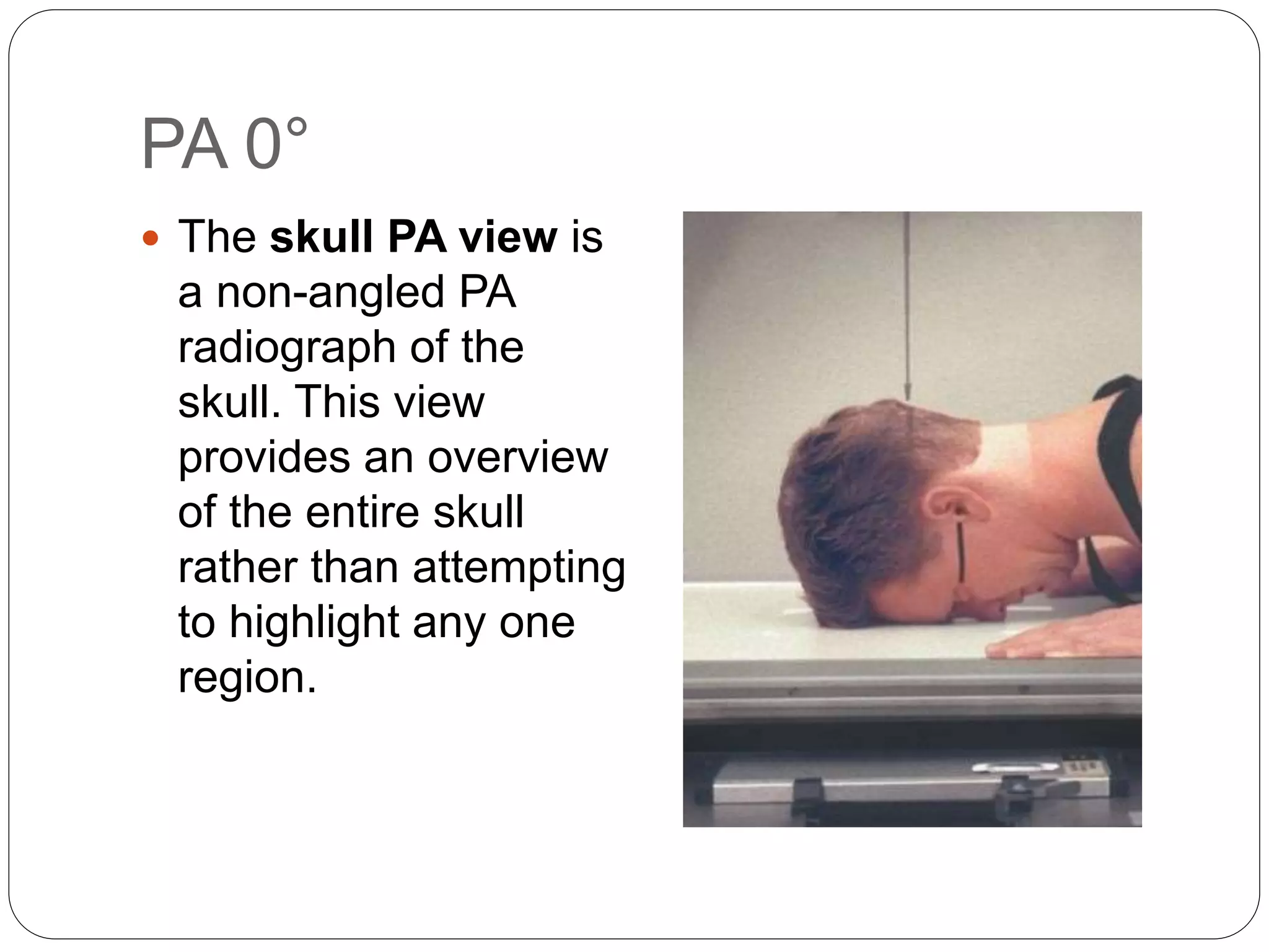 Skull anatomy and positioning | PPTX