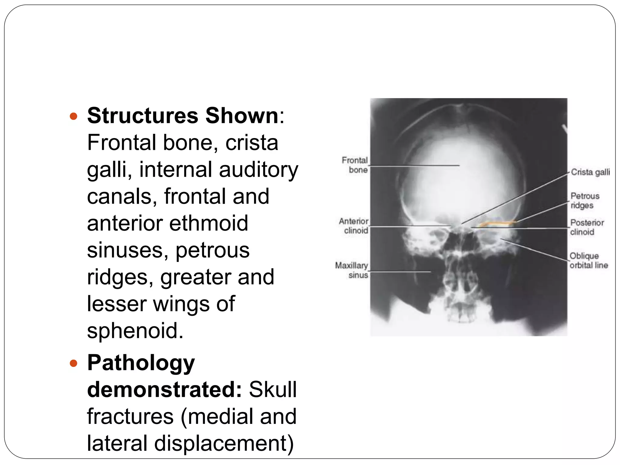 Skull anatomy and positioning | PPTX