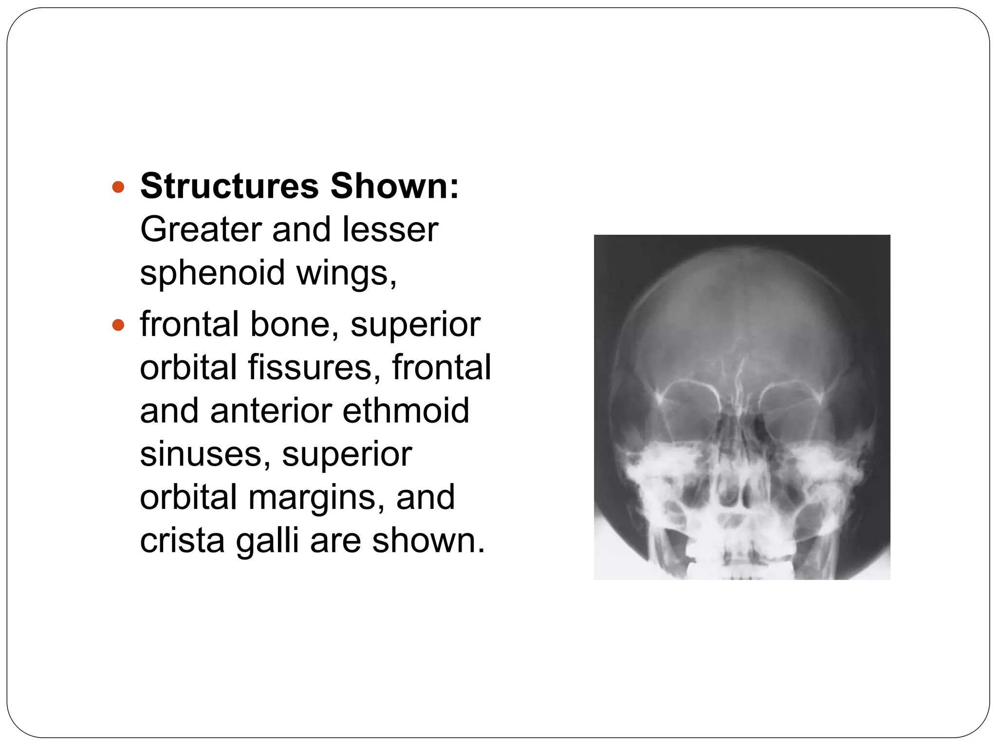 Skull anatomy and positioning | PPTX