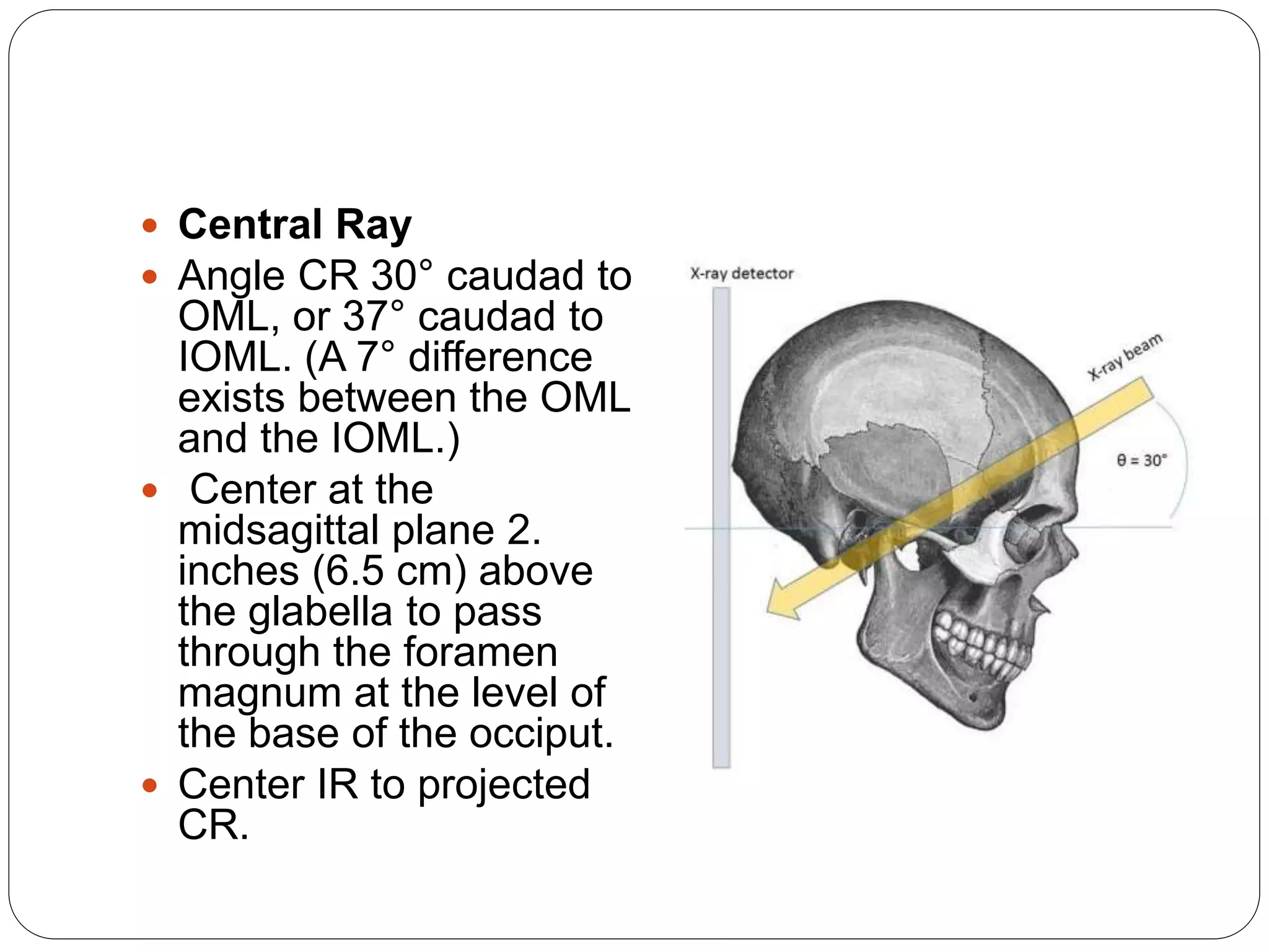 Skull anatomy and positioning | PPTX