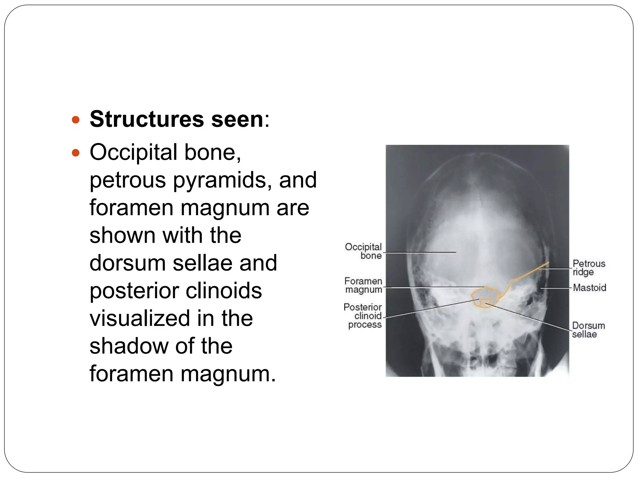 Skull anatomy and positioning | PPTX