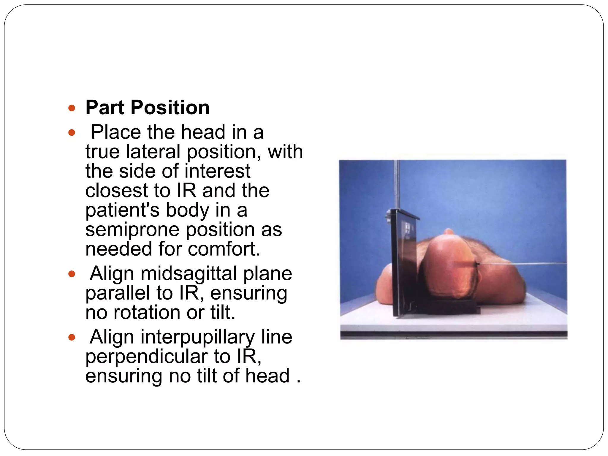 Skull anatomy and positioning | PPTX
