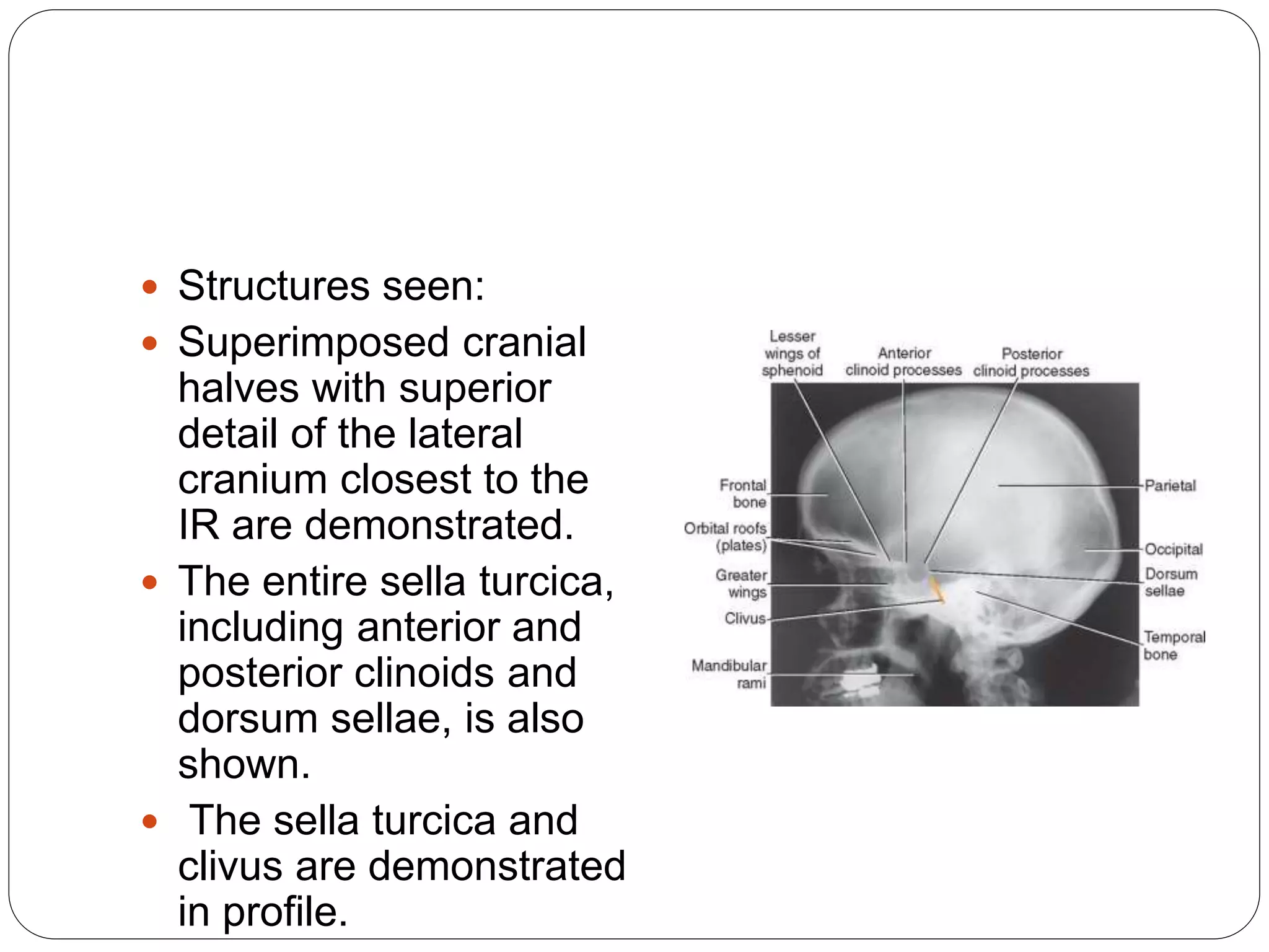 Skull anatomy and positioning | PPTX