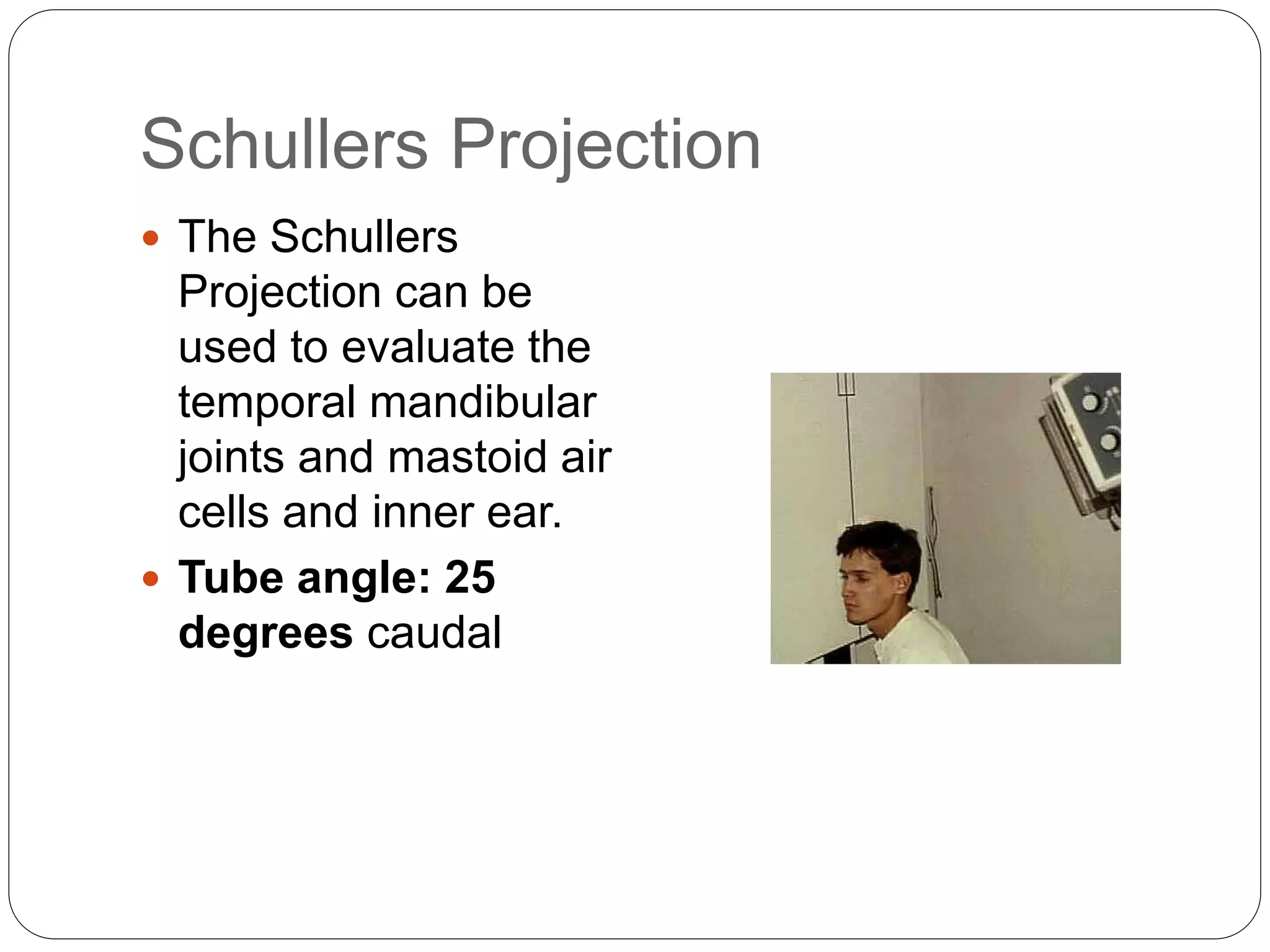 Skull anatomy and positioning | PPTX