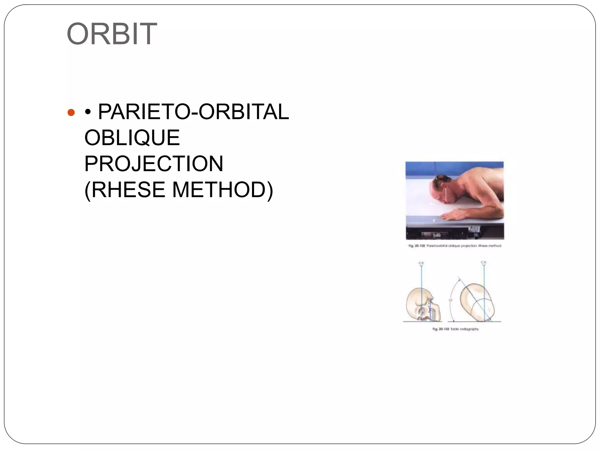 Skull anatomy and positioning | PPTX