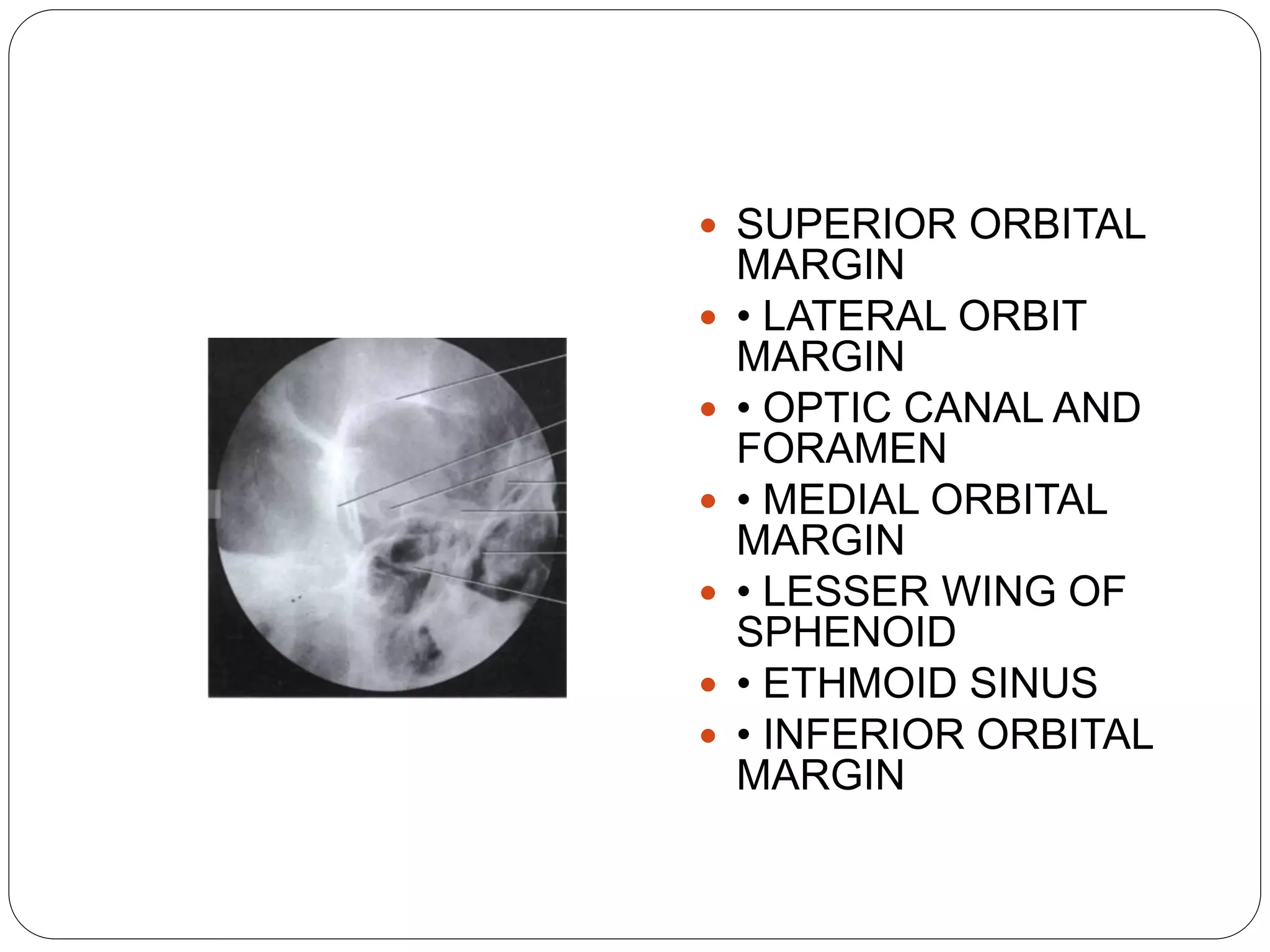 Skull anatomy and positioning | PPTX