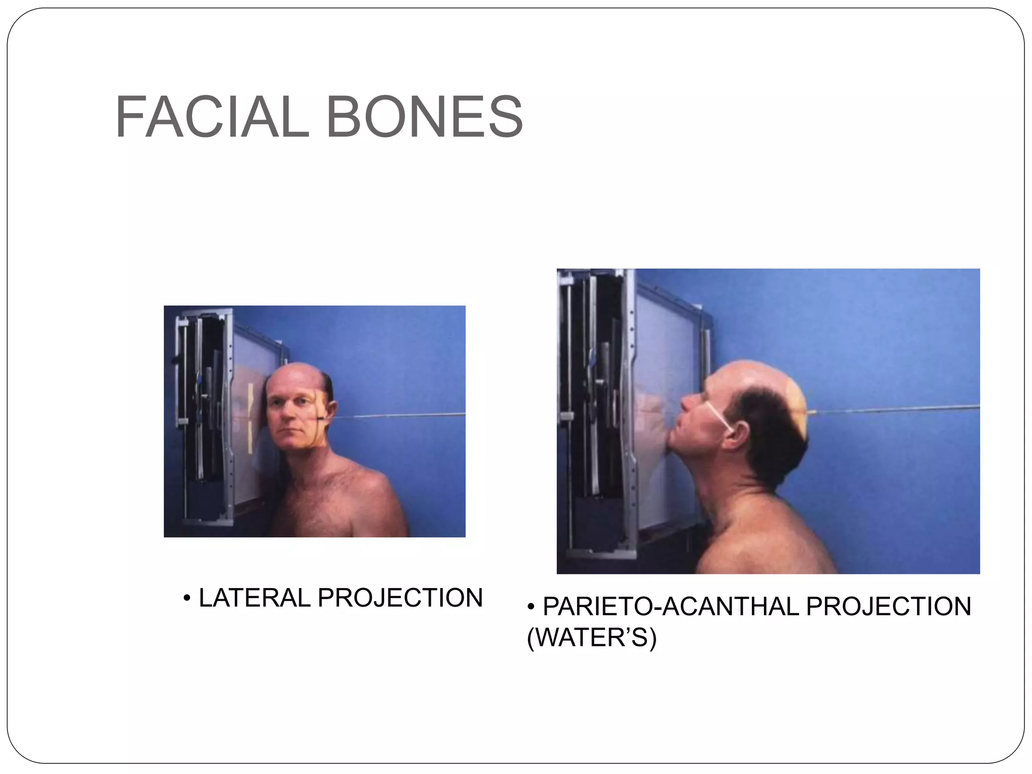 Skull anatomy and positioning | PPTX