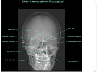 Skull anatomy and positioning | PPTX