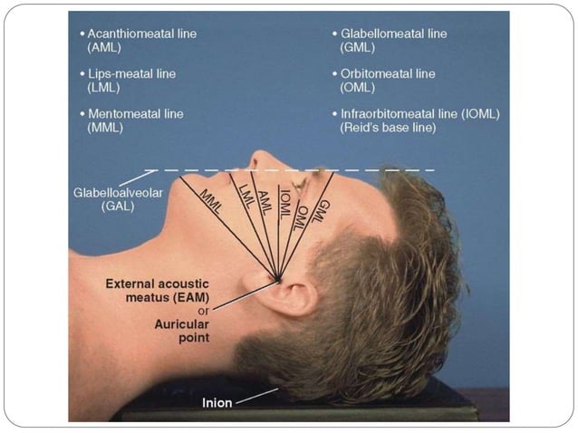 Skull anatomy and positioning | PPTX