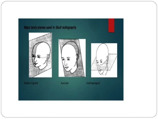 Skull anatomy and positioning | PPTX